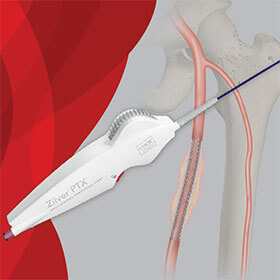 Peripheral Intervention | Cook Medical