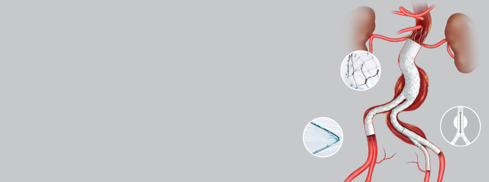 Aortic Intervention | Cook Medical