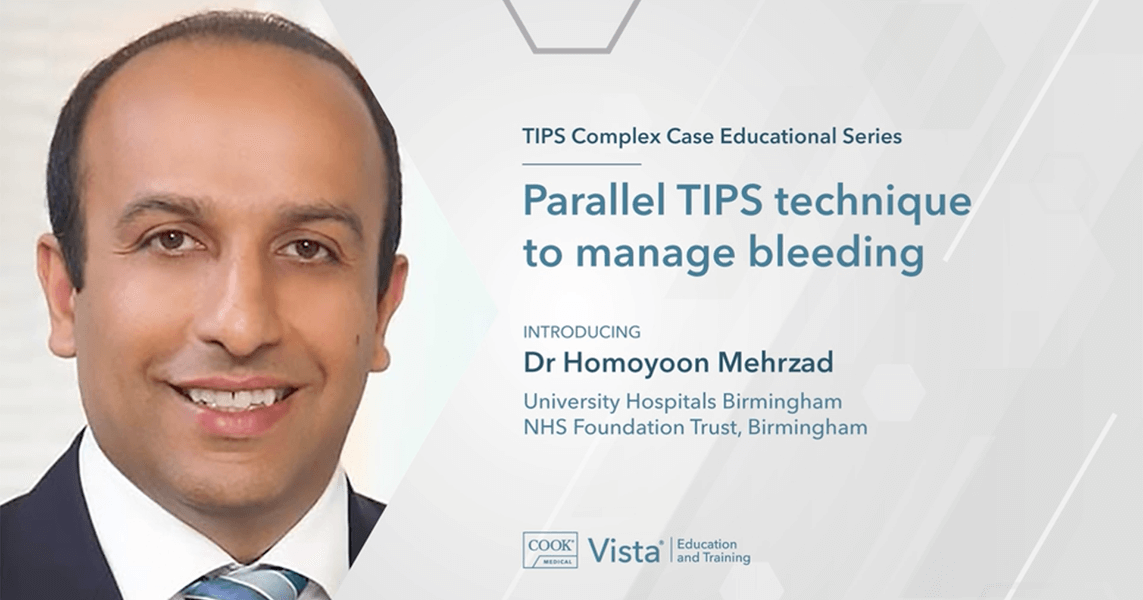 TIPS Complex Case Series: Parallel TIPS technique | Cook Medical